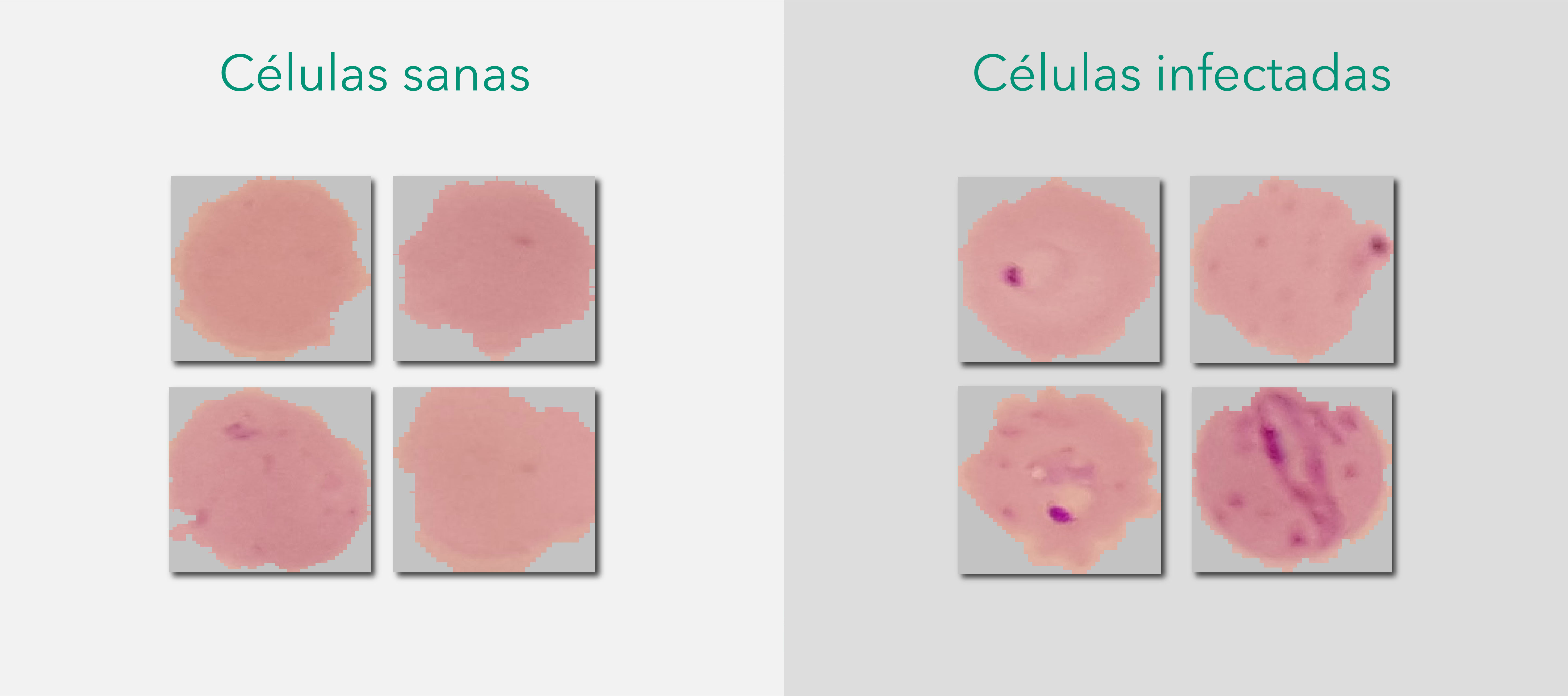 Data for Good: ¿Puede el deep learning ayudarnos a diagnosticar ...