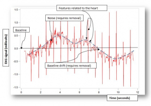 How WAVELETS can help separate the signal from the noise - The SAS Data Science Blog